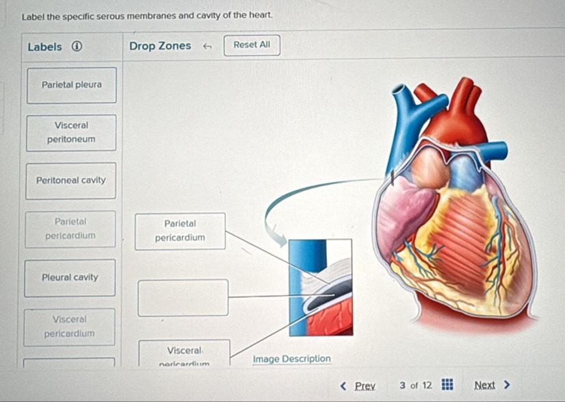 Solved: Label the specific serous membranes and cavity of the heart ...