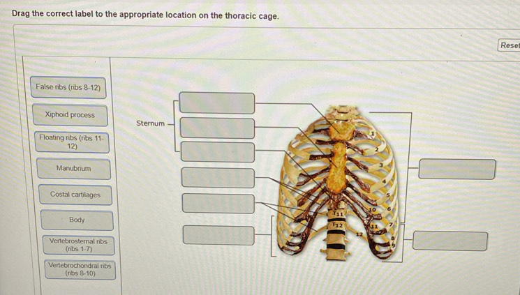 Solved: Drag the correct label to the appropriate location on the ...