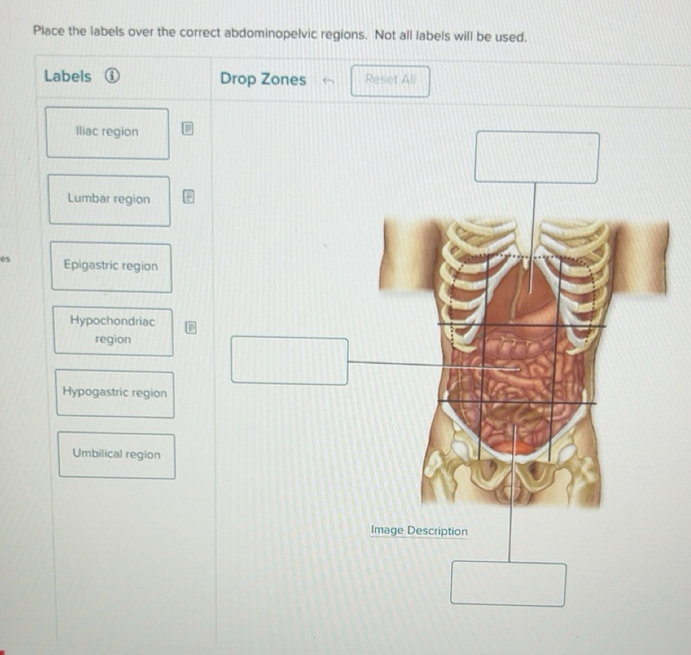 Solved: Place the labels over the correct abdominopelvic regions. Not ...