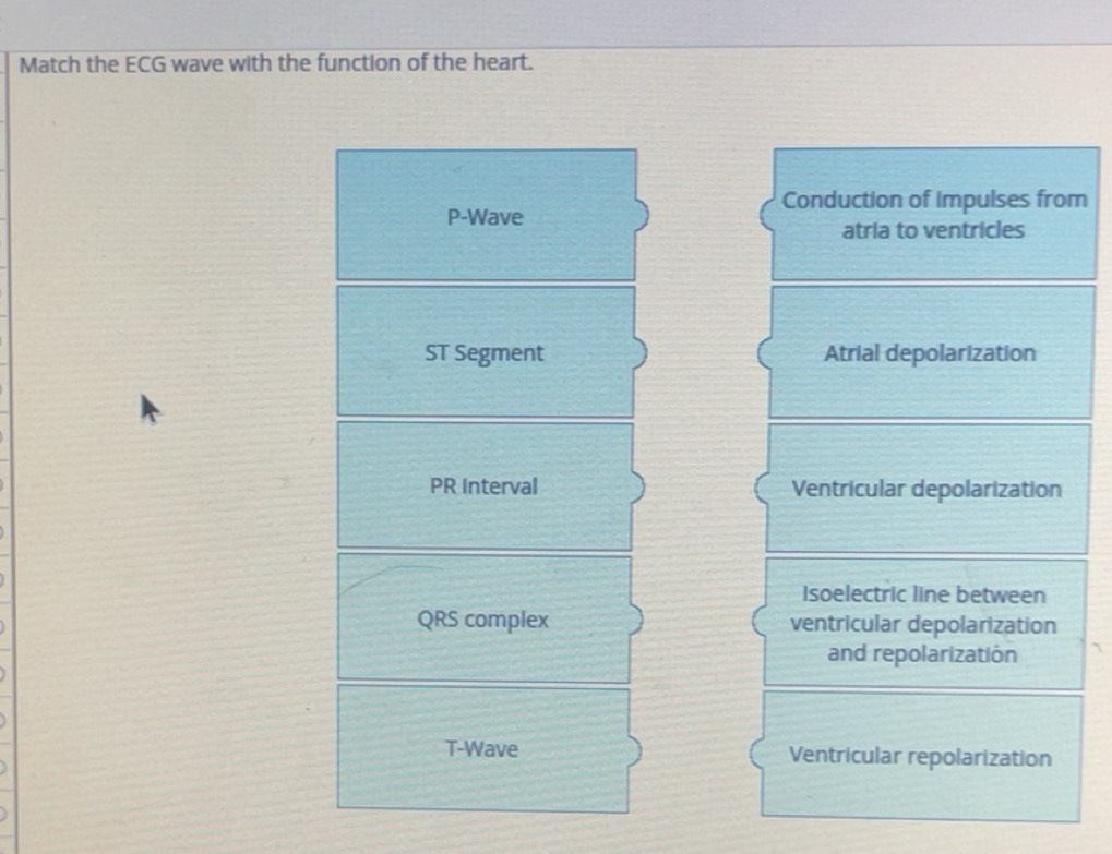 Solved: Match the ECG wave with the function of the heart. Conduction ...