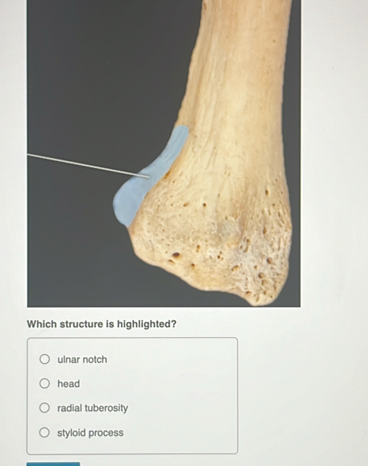 Solved: Which structure is highlighted? ulnar notch head radial ...