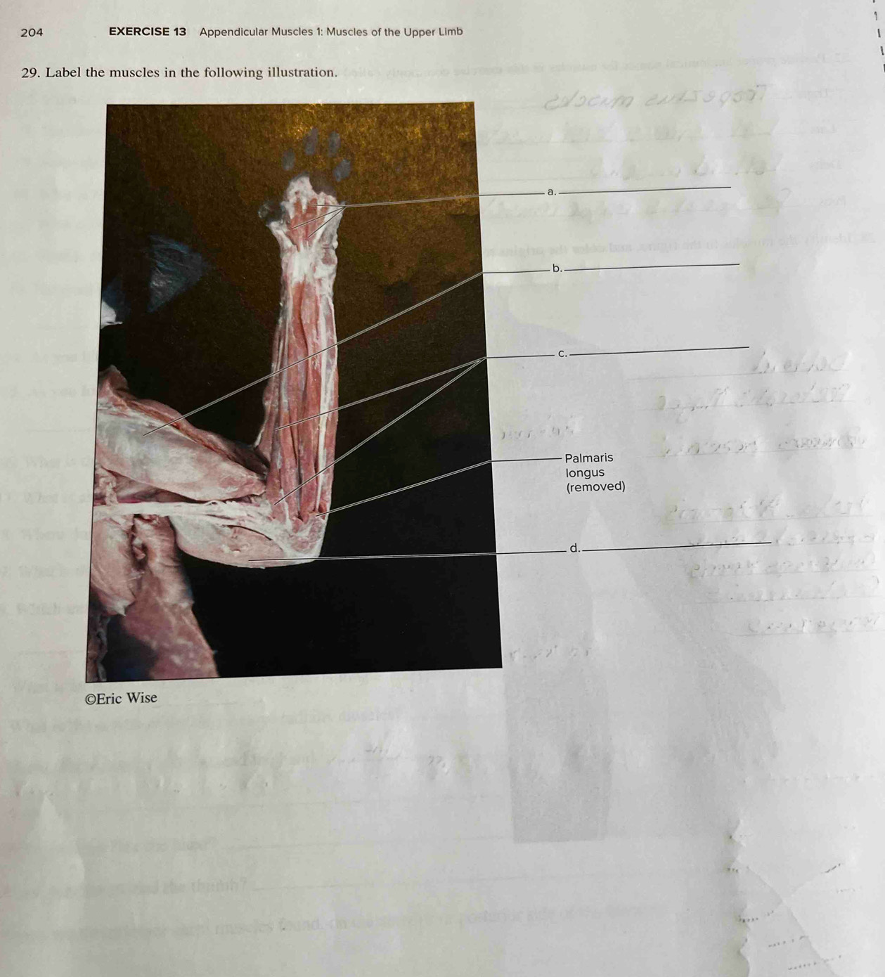 Solved: 204 EXERCISE 13 Appendicular Muscles 1: Muscles of the Upper ...