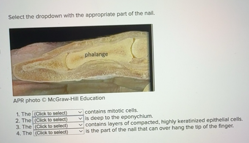 Solved: Select the dropdown with the appropriate part of the nail. APR ...