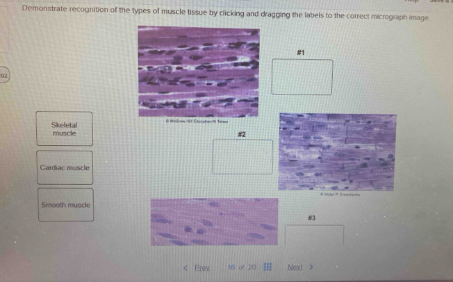 Solved: Demonstrate recognition of the types of muscle tissue by ...