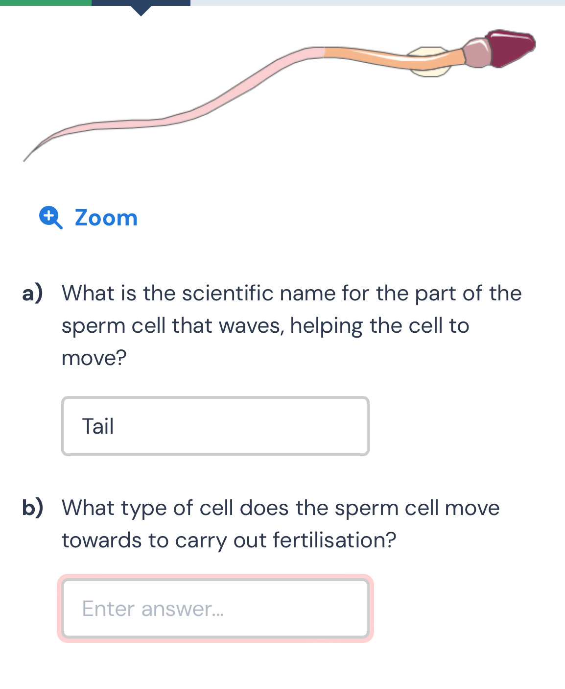 Solved: Zoom a) What is the scientific name for the part of the sperm ...
