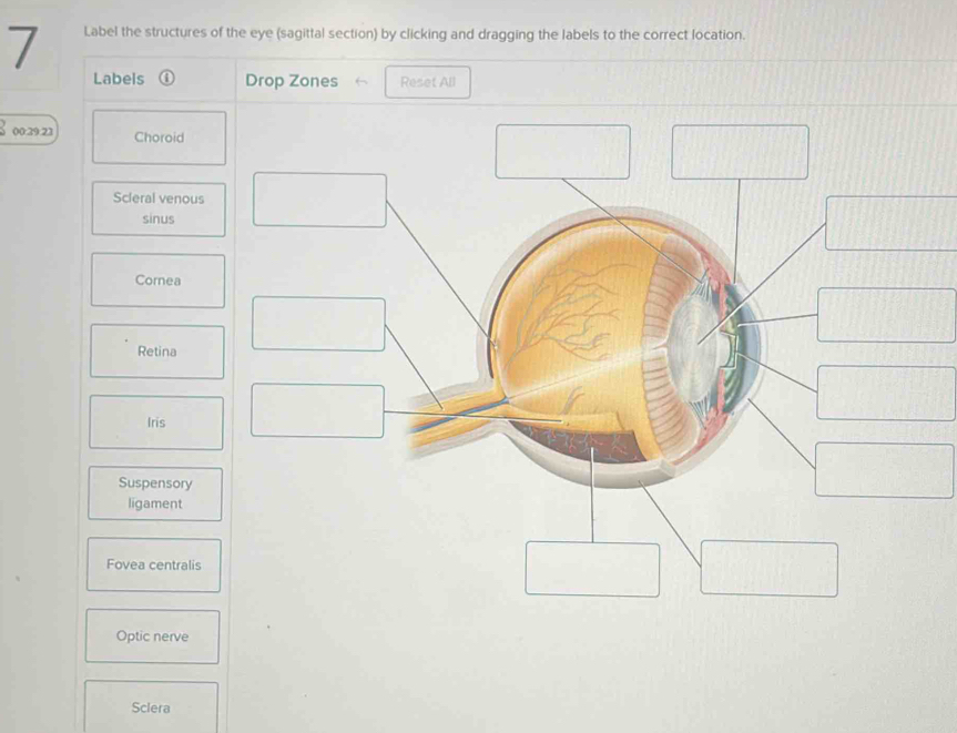 Solved: Label the structures of the eye (sagittal section) by clicking ...