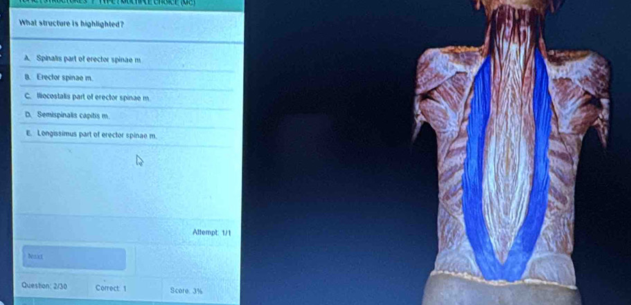 Solved: What structure is highlighted? A. Spinalis part of erector ...