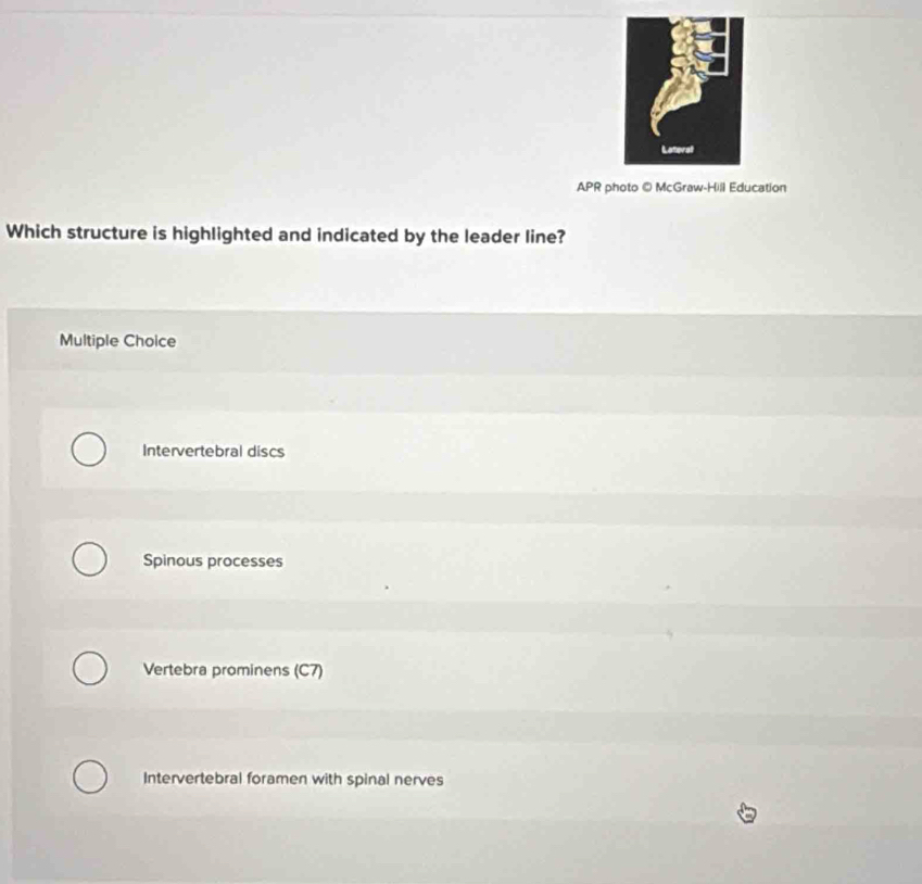 Solved: APR photo © McGraw-Hill Education Which structure is highlighted and indicated by the ...