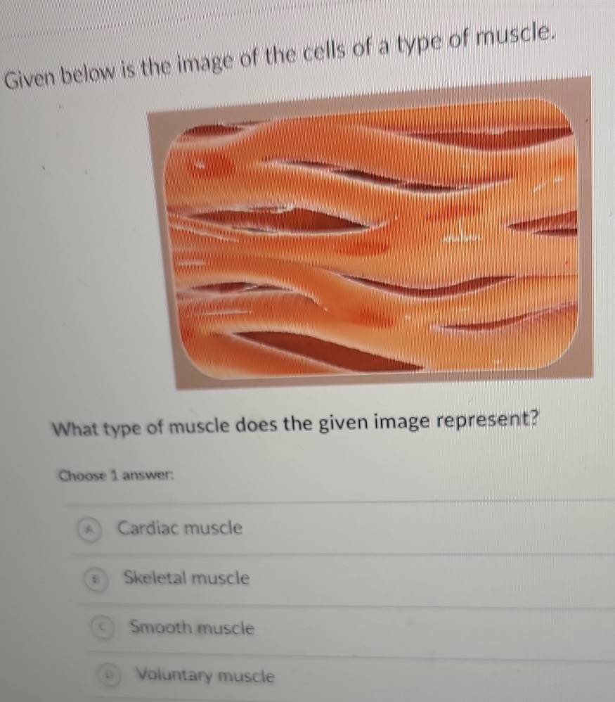 Solved: Given below ithe image of the cells of a type of muscle. What ...