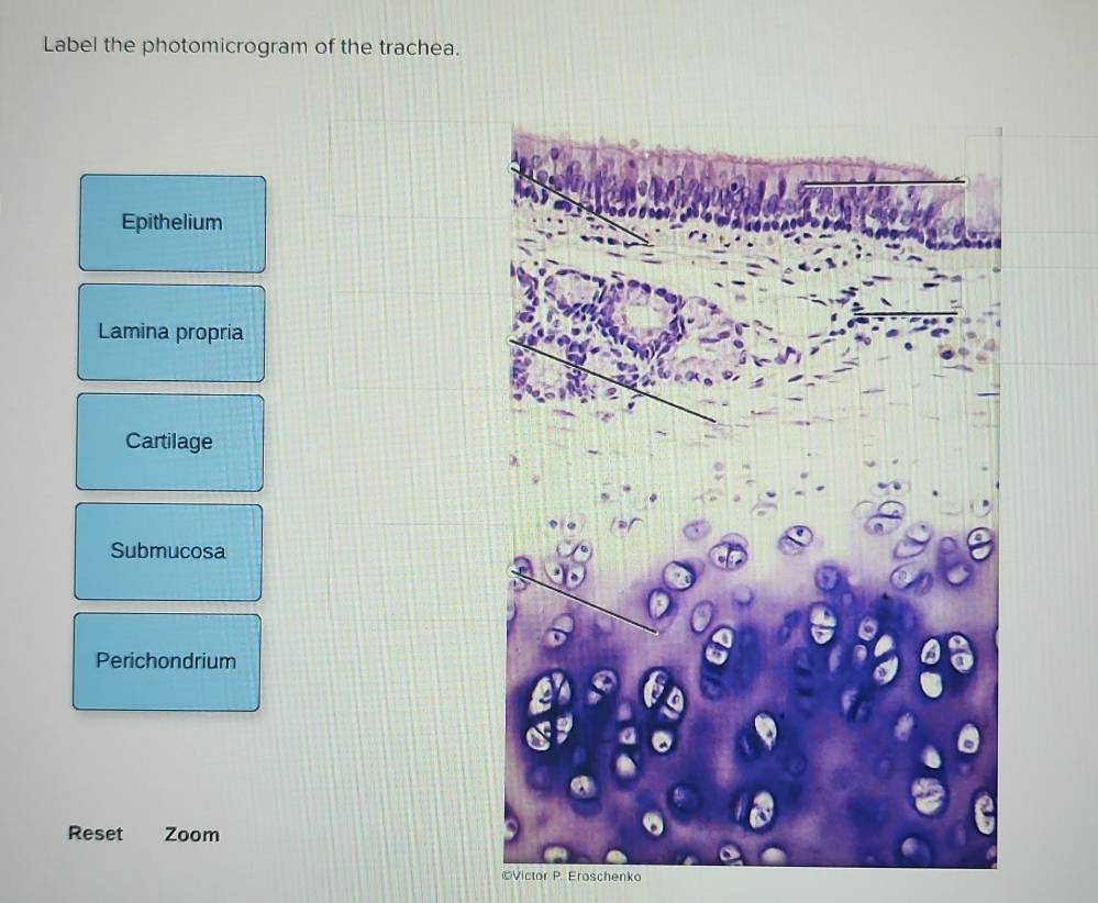 Solved: Label the photomicrogram of the trachea. Epithelium Lamina ...