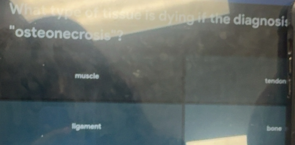 Solved: What type of tissue is dying if the diagnosis "osteonecrosis ...
