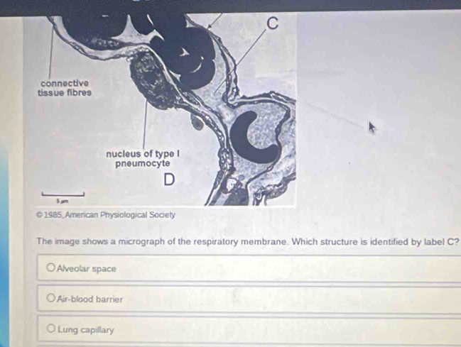 Solved: The image shows a micrograph of the respiratory membrane. Which ...