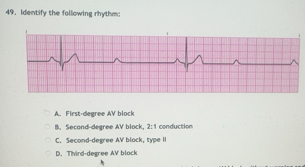 Solved: Identify the following rhythm: A. First-degree AV block B ...