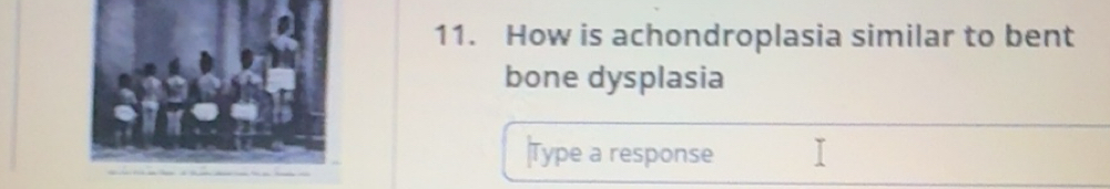 Solved: How is achondroplasia similar to bent bone dysplasia |Type a ...