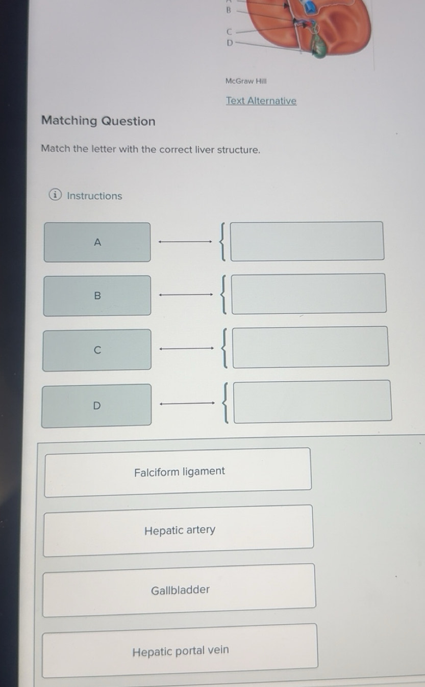 Solved: McGraw Hill Text Alternative Matching Question Match the letter ...