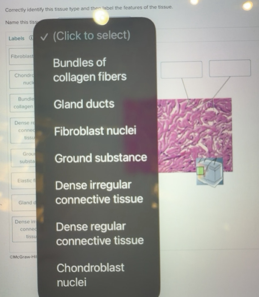 Solved: Correctly identify this tissue type and then label the features ...