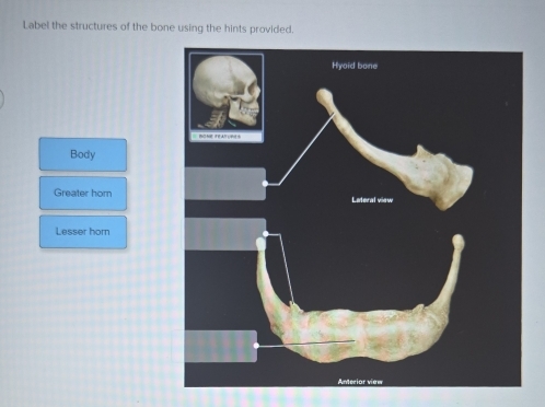Solved: Label the structures of the bone using the hints provided. Body Greater horn Lesser hor ...