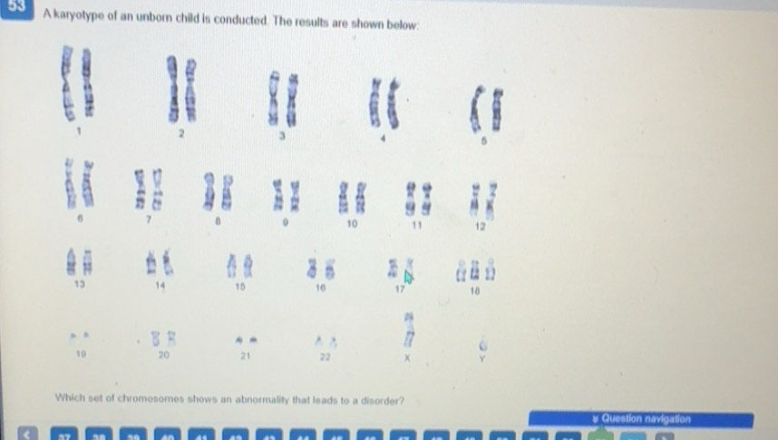 Solved: A karyotype of an unborn child is conducted. The results are ...