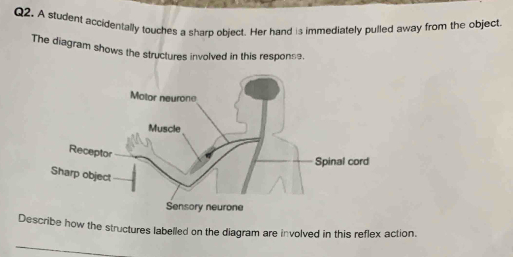 Solved: A student accidentally touches a sharp object. Her hand is immediately pulled away from ...
