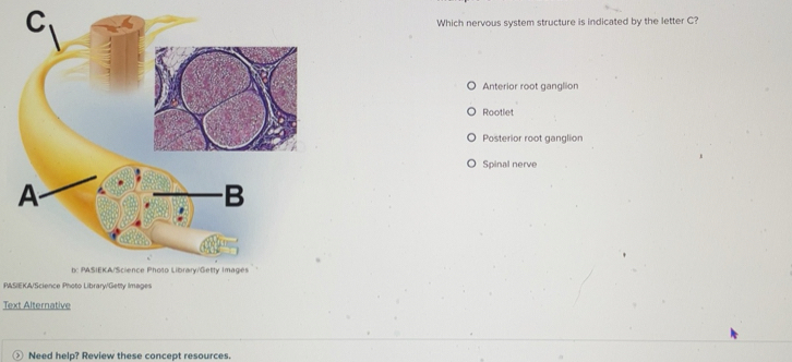Solved: Which nervous system structure is indicated by the letter C ...