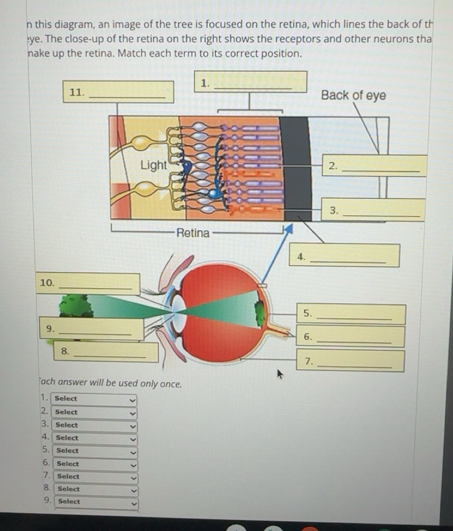 Solved: this diagram, an image of the tree is focused on the retina ...