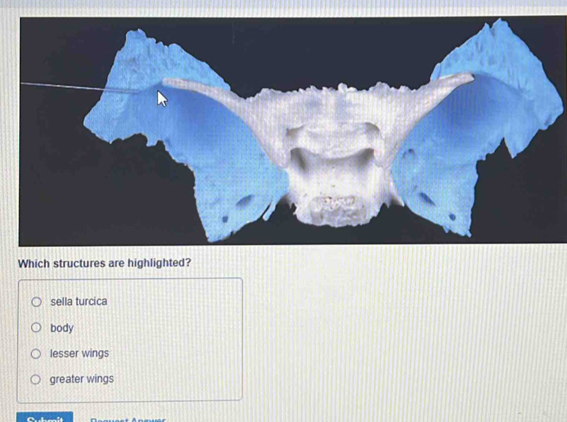 Solved: Which structures are highlighted? sella turcica body lesser ...