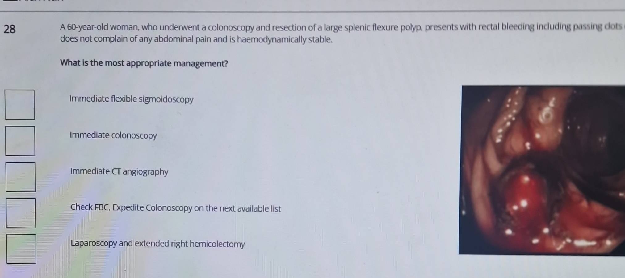 Solved: A 60-year-old woman, who underwent a colonoscopy and resection ...