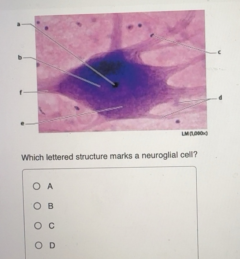 Solved: Which lettered structure marks a neuroglial cell? A B C D [Biology]