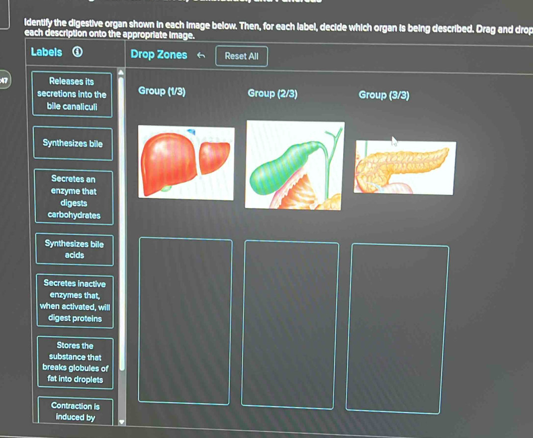 Solved: identify the digestive organ shown in each image below. Then ...