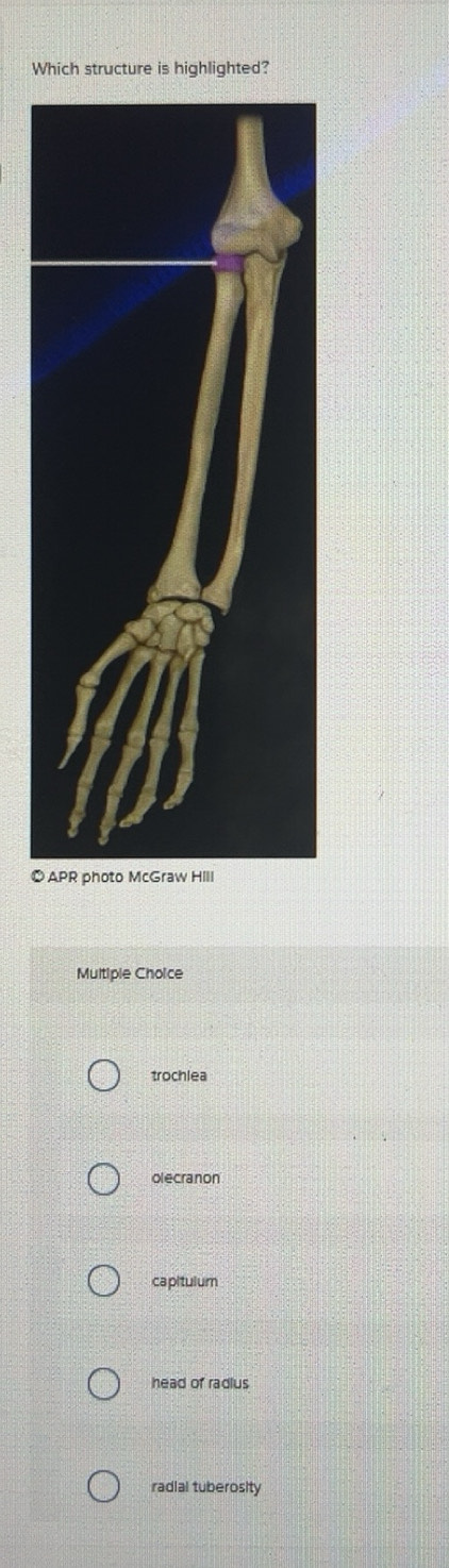 Solved: Which structure is highlighted? © Multiple Choice trochlea ...