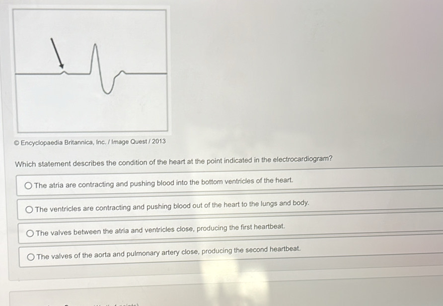 Solved: Which statement describes the condition of the heart at the ...
