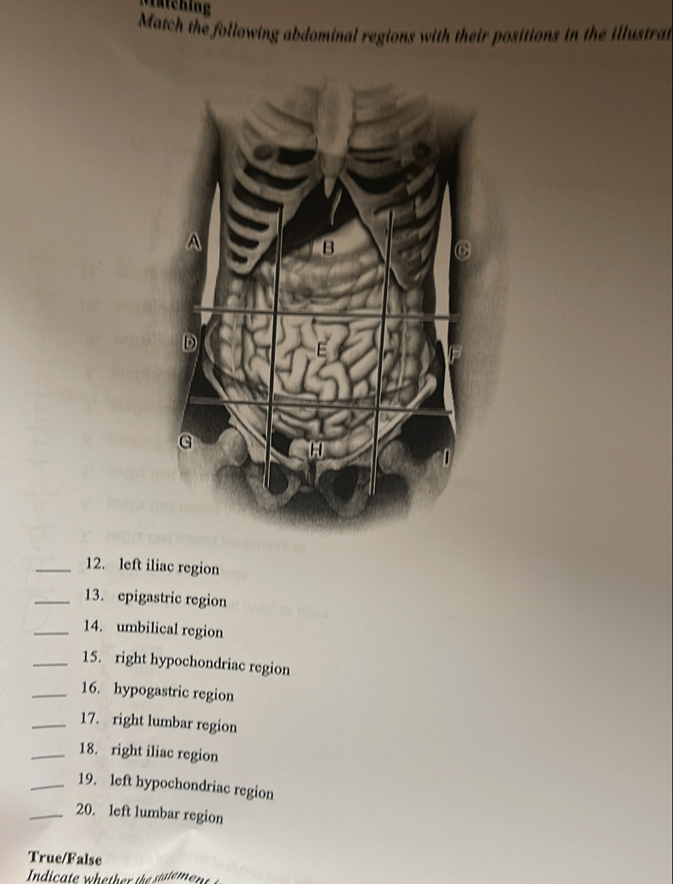Solved: Matehing Match the following abdominal regions with their ...