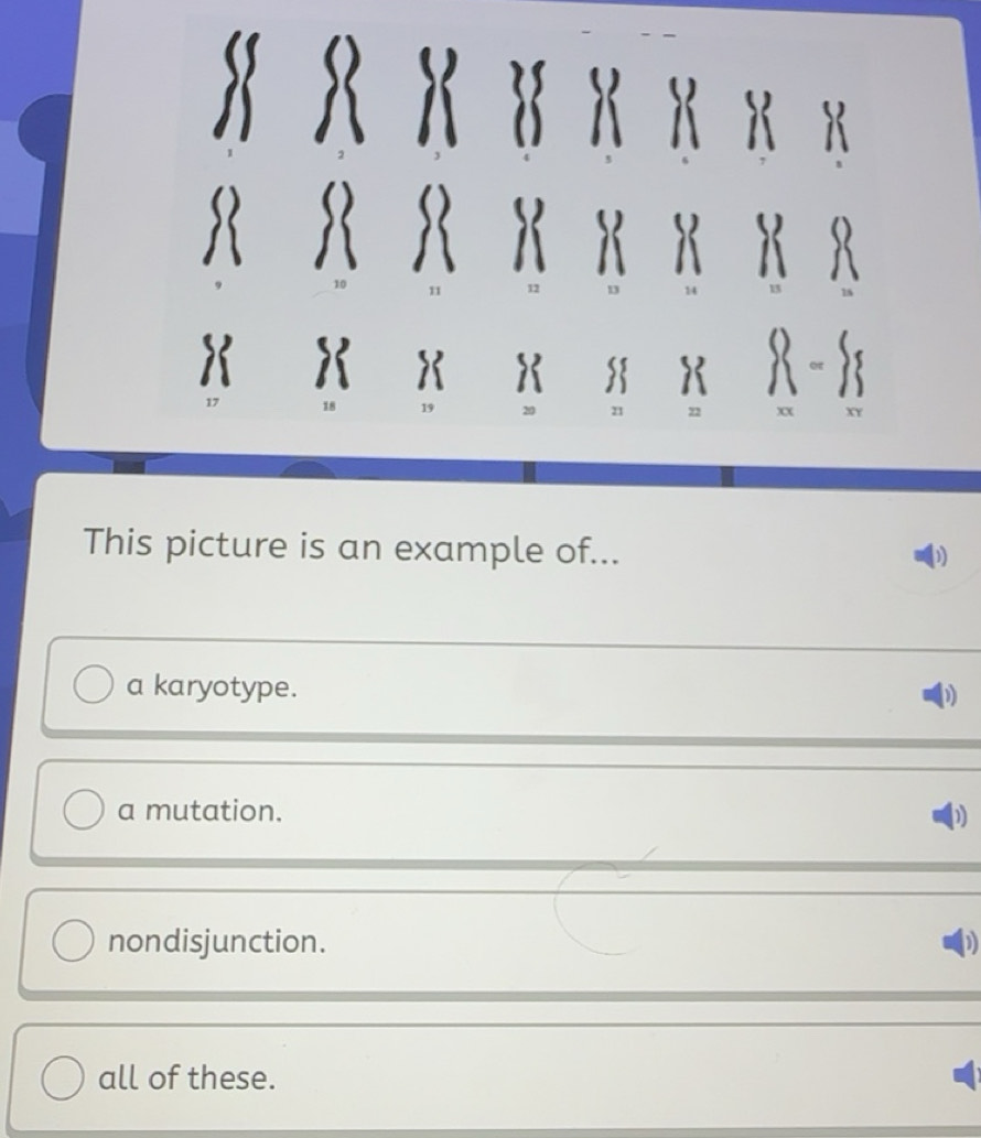 Solved: 8 18 20 22 xx This picture is an example of... a karyotype. a ...