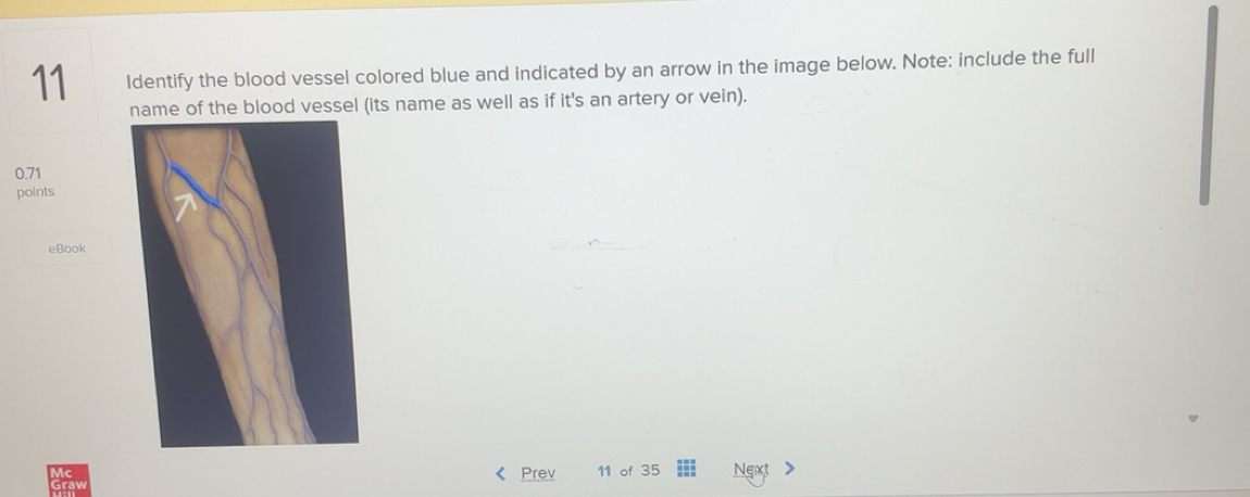 Solved: Identify the blood vessel colored blue and indicated by an ...