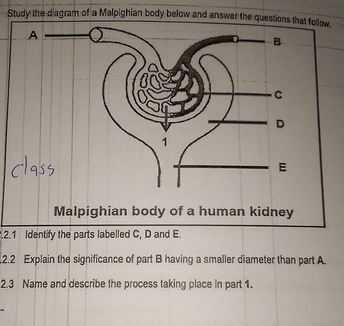 Solved: Study the diagram of a Malpighian body below and answer the ...