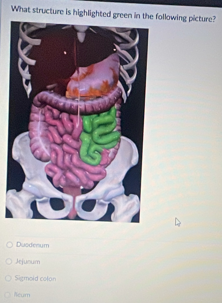 Solved: What structure is highlighted green in the following picture? Duodenum Jejunum Sigmoid ...