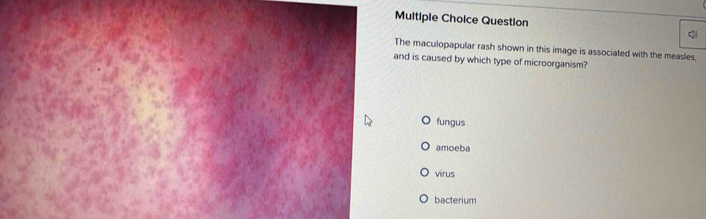 Solved: Question The maculopapular rash shown in this image is ...