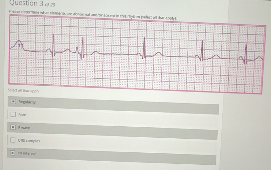 Solved: Please determine what elements are abnormal and/or absent in this rhythm (select all ...