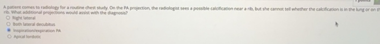 Solved: A patient comes to radiology for a routine chest study. On the ...