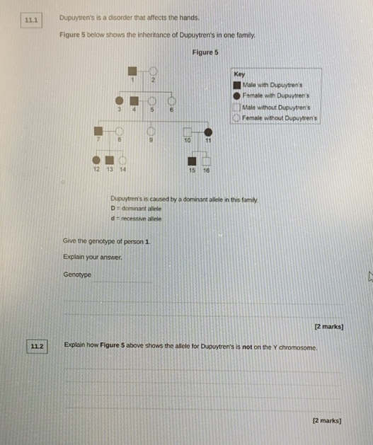 Solved: 11.1 Dupuytren's is a disorder that affects the hands. Figure 5 ...