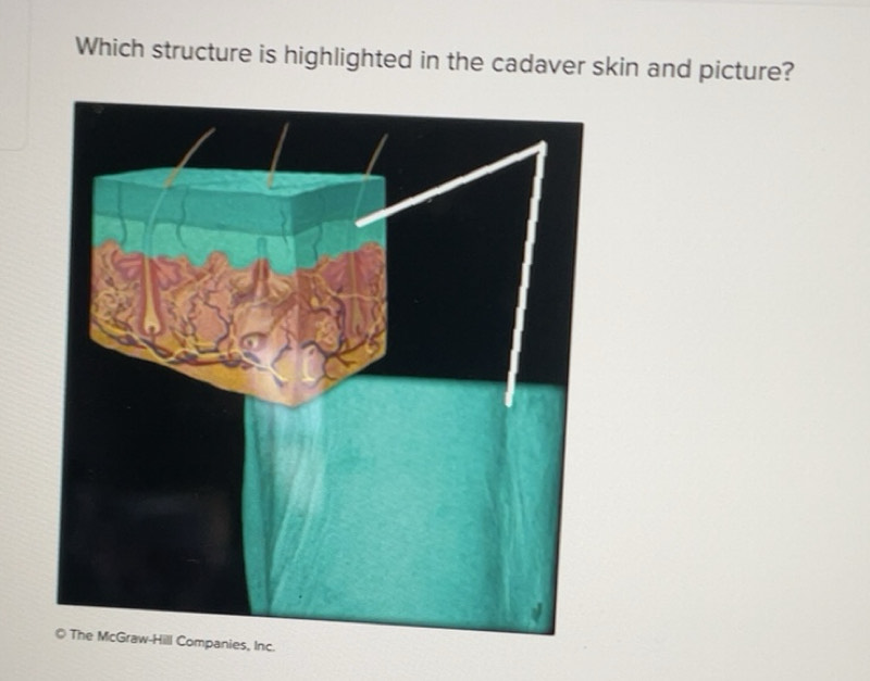 Solved: Which structure is highlighted in the cadaver skin and picture ...