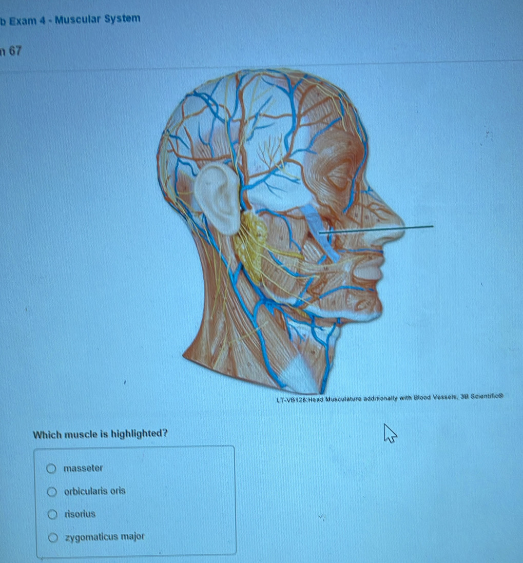 Solved: Exam 4 - Muscular System n 67 els, 3B Scientific& Which muscle ...