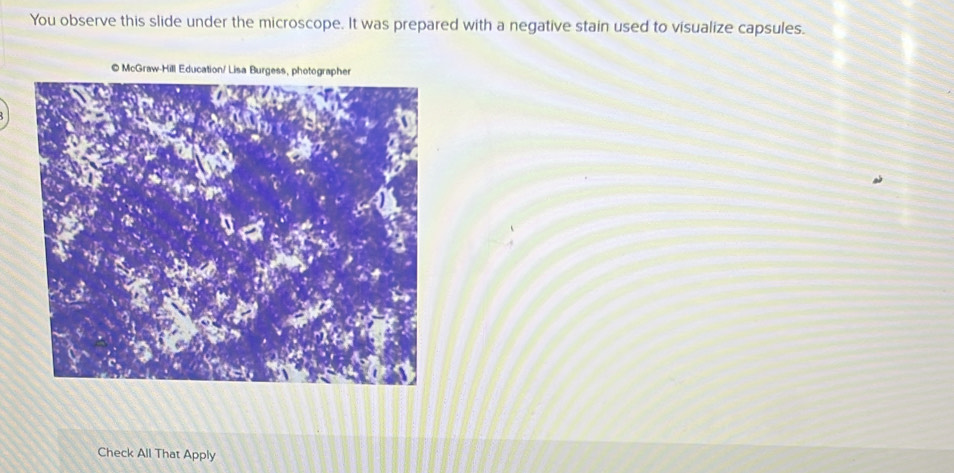 Solved: You observe this slide under the microscope. It was prepared ...