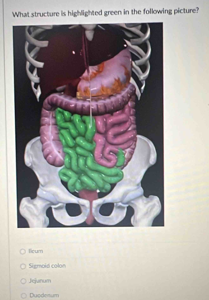 Solved: What structure is highlighted green in the following picture ...