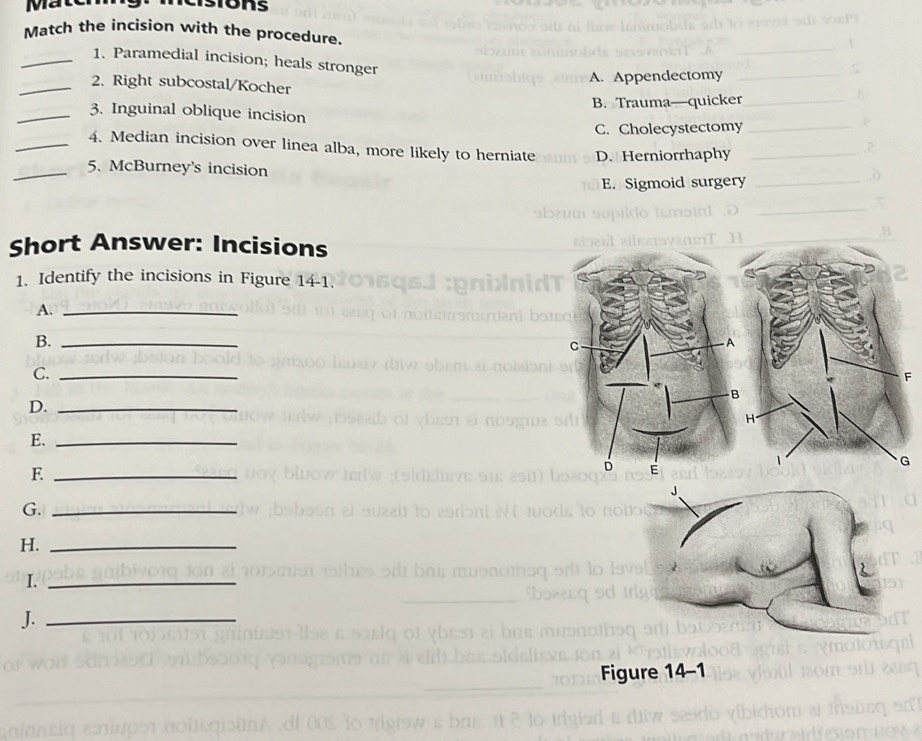 Solved: Mate Match the incision with the procedure. _ _1. Paramedial ...