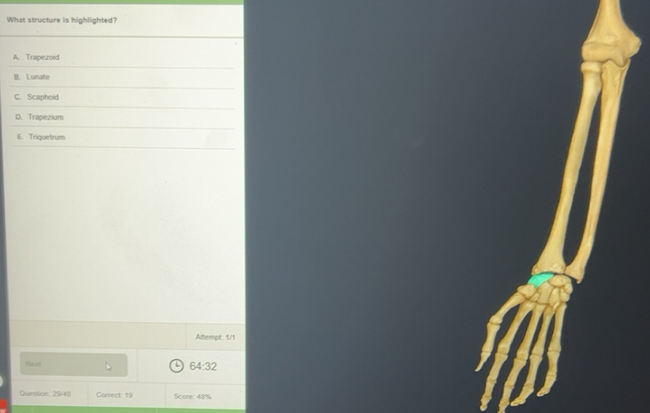 Solved: What structure is highlighted? A. Trapezoid B. Lunate C ...