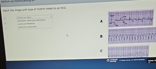 Solved: Perform an Electrocardiogram Match the image with type of ...