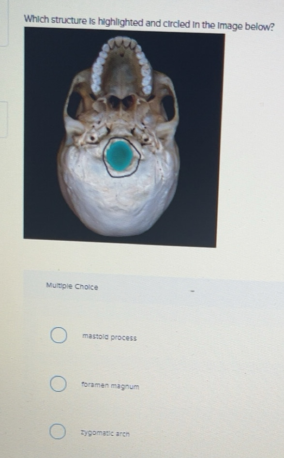 Solved: Which structure is highlighted ge below? Multiple Choice ...