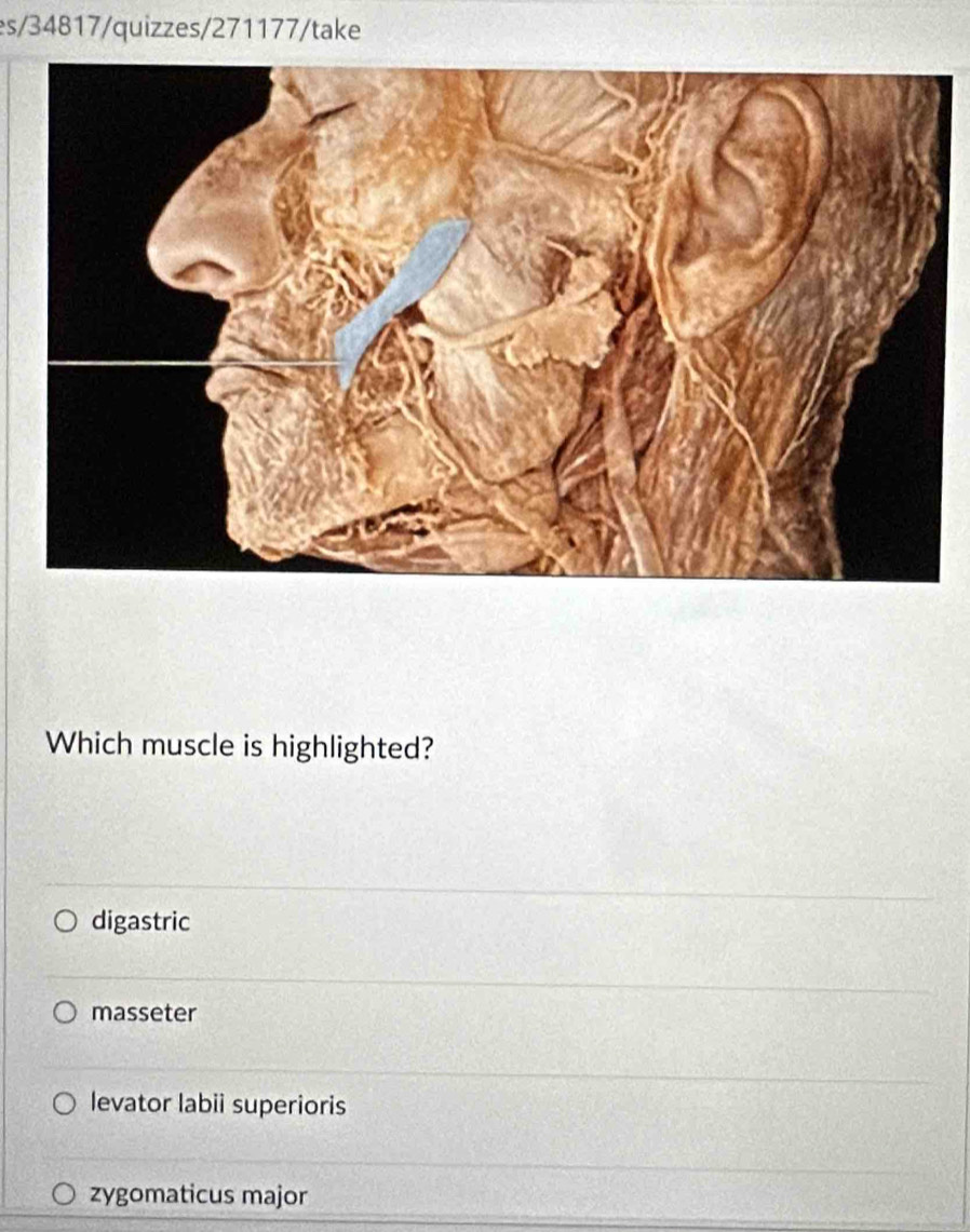 Solved: es/34817/quizzes/271177/take Which muscle is highlighted ...