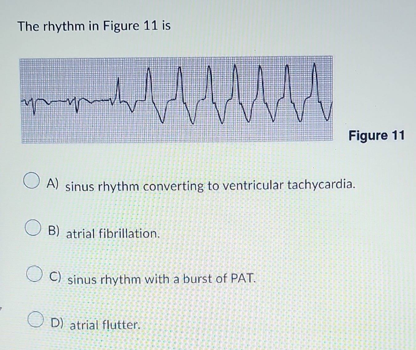 Solved: The rhythm in Figure 11 is ure 11 A) sinus rhythm converting to ...